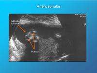 Auffälligkeiten des Zentralen Nervensystems